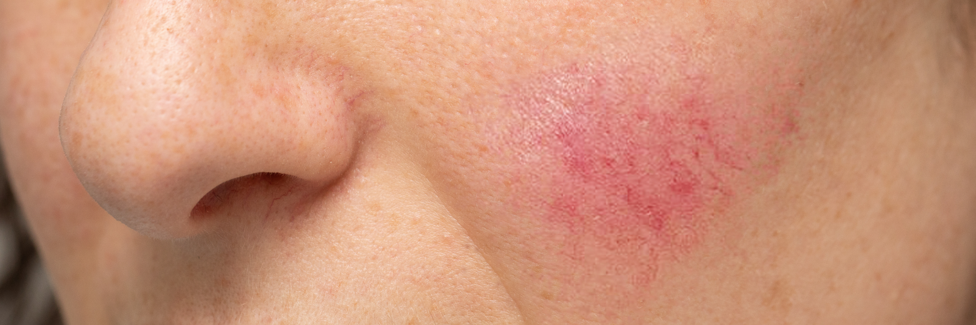 Skin Conditions & Rashes